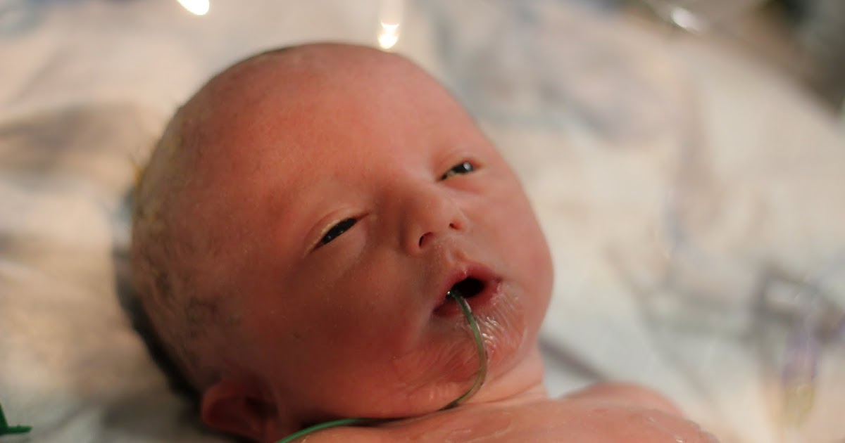 knowledge for Trisomy 18 ~ News Online