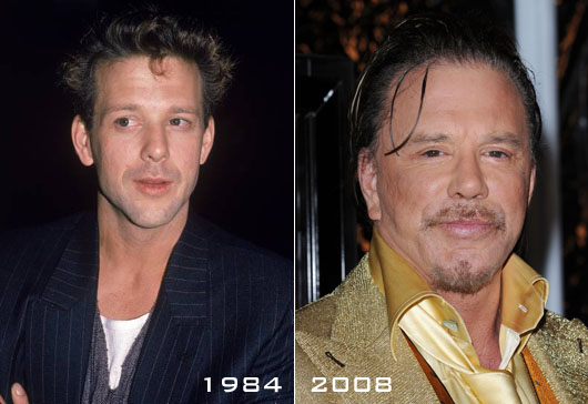 Mickey Rourke Plastic Surgery