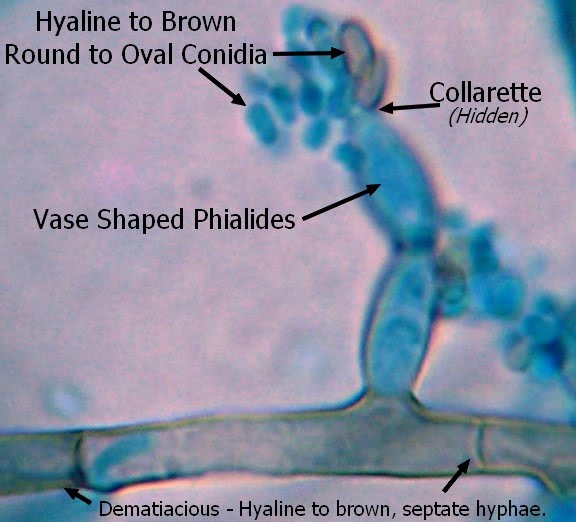 Lecture Notes in Medical Technology: Lecture #16: INTRODUCTION TO MYCOLOGY