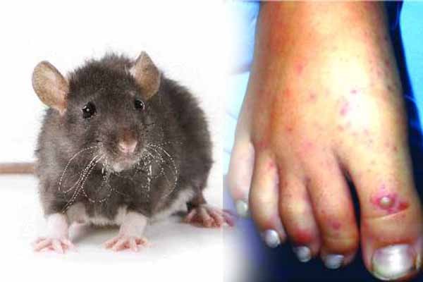 யாழில் எலிக்காய்ச்சலால் பொலிஸ் உத்தியோகத்தர் பலி - pathivu