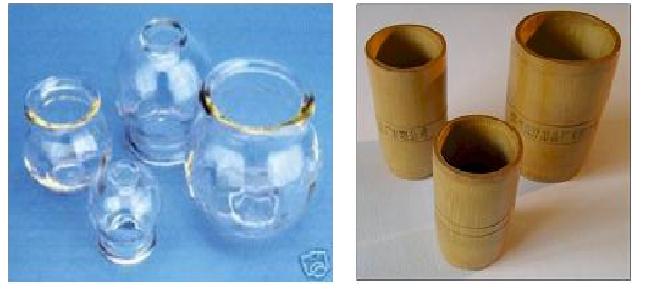 Conversation with an acupuncturist: cupping and moxibustion