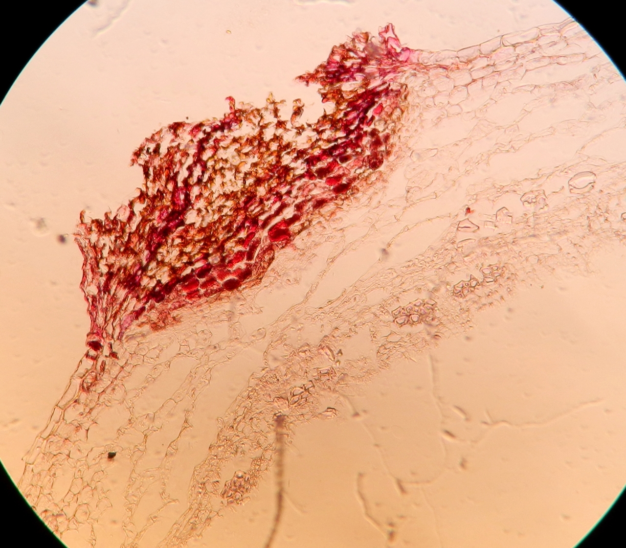 PooR pRinZa aPpLe: Lentisel Sambucus javanica