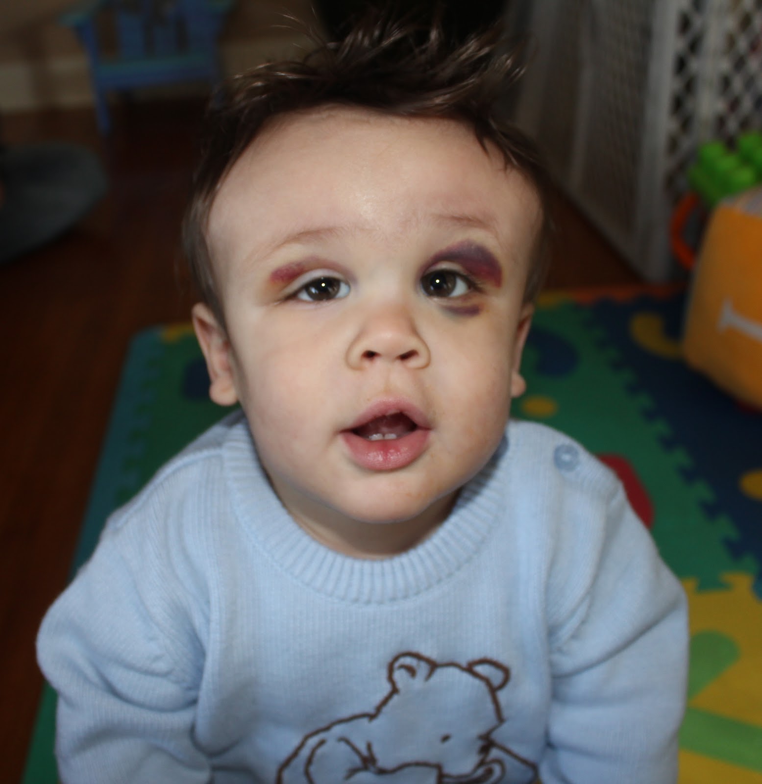 Grayson's Cranio Story