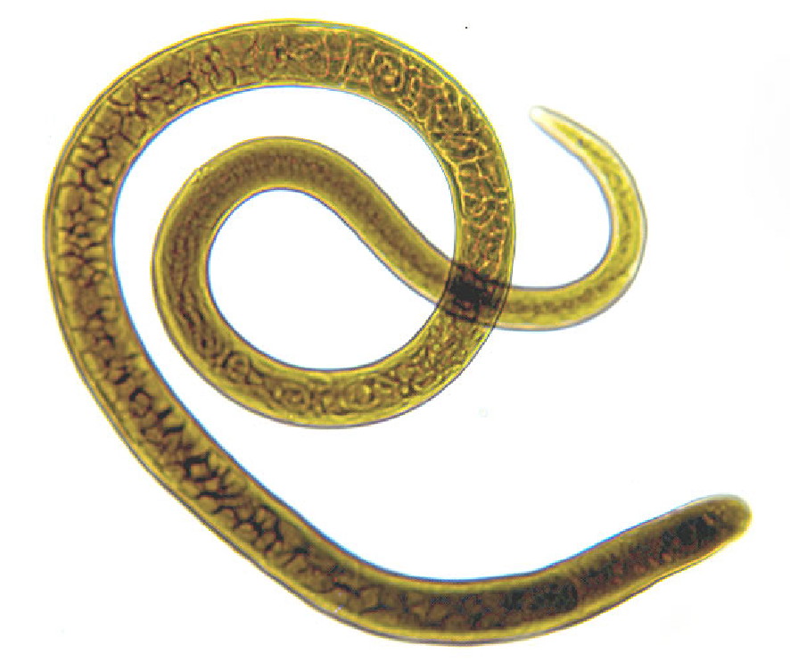 smart_ebook: Cacing cambuk (trichinella spiralis)