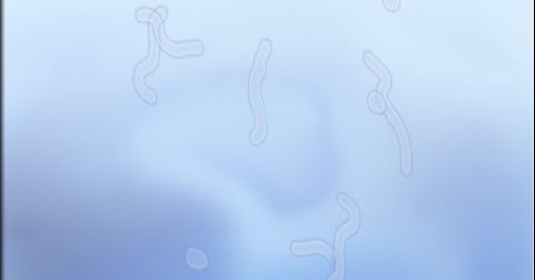 What Causes “Eye Floaters” ? - Pics And Gifs