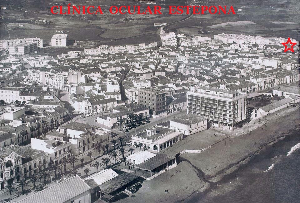 DEGENERACION MACULAR : DRUSAS...en la retina