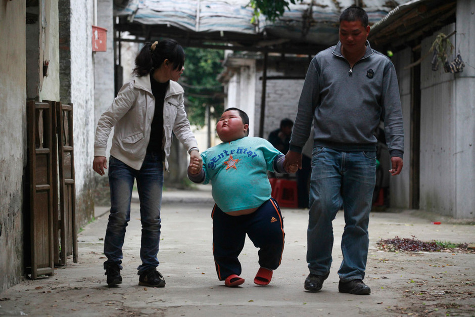 Anecdote World: 4-year-old super-fat baby, weighing over 120 pounds