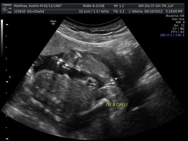 Lovin' On Littles: 21 Week Ultrasound