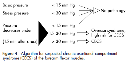Tom's Physiotherapy Blog: Compartment Syndrome