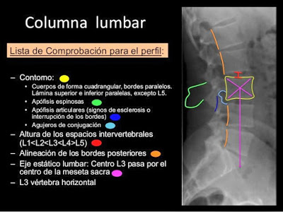 ZONA DE SALUD DE OFRA: Cómo interpretar una radiografía de columna lumbar.