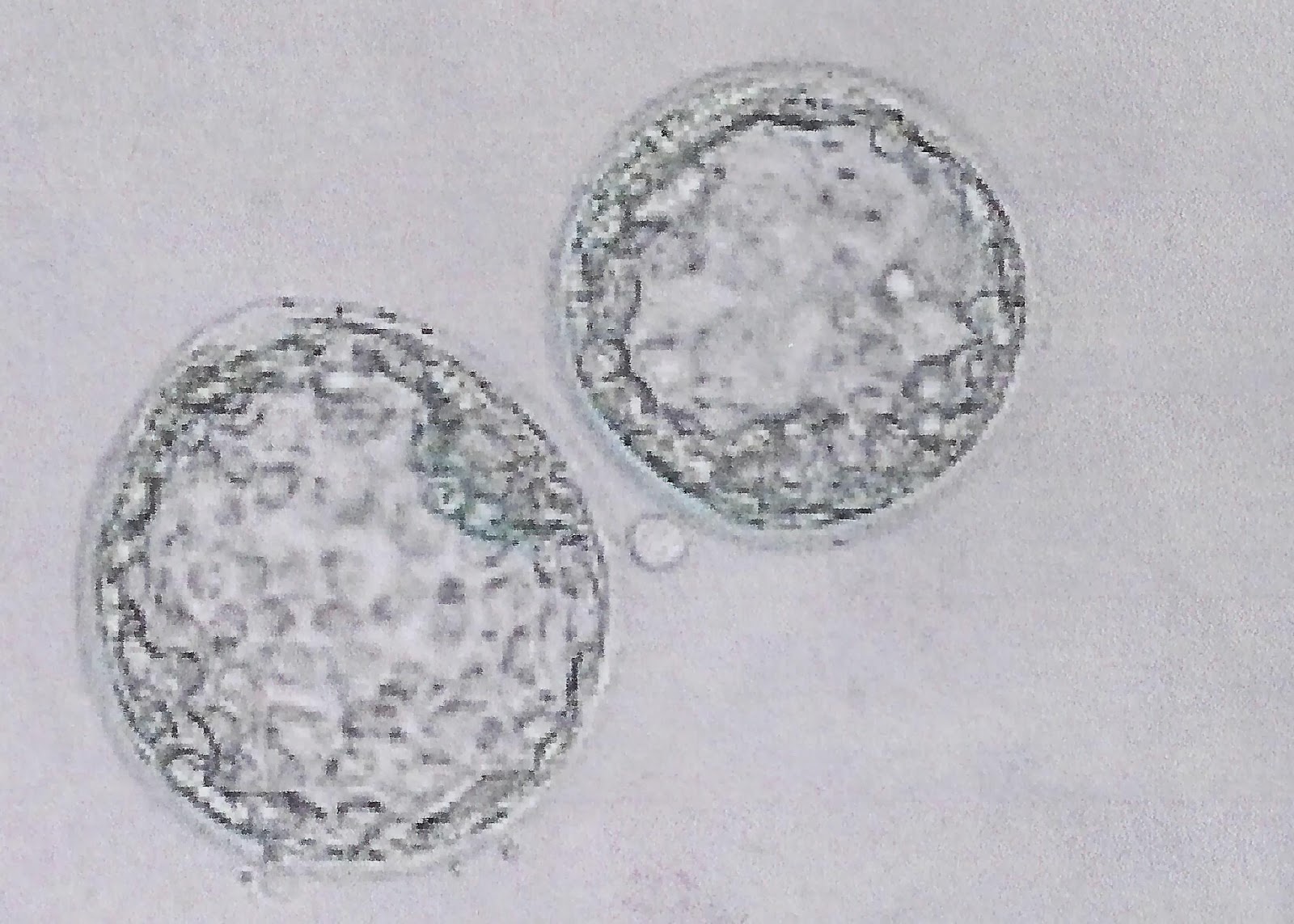 Pre-Born Babies: A Snowflake Is Born - Zoe's Story