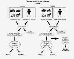 Medical Treatment Pictures-for Better Understanding: Maple Syrup Urine ...