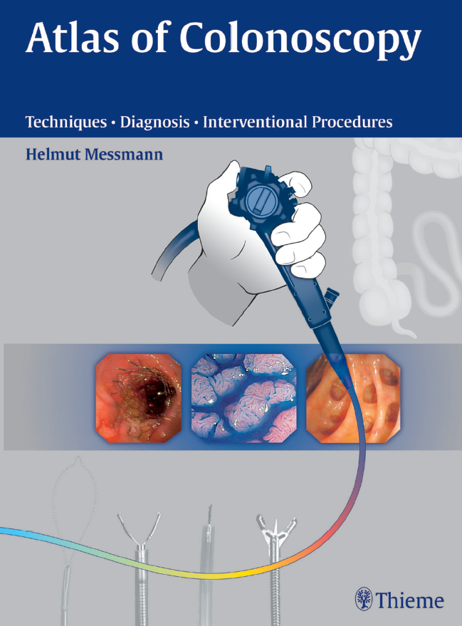 Atlas of Colonoscopy: Examination Techniques and Diagnosis 1st Edition ...