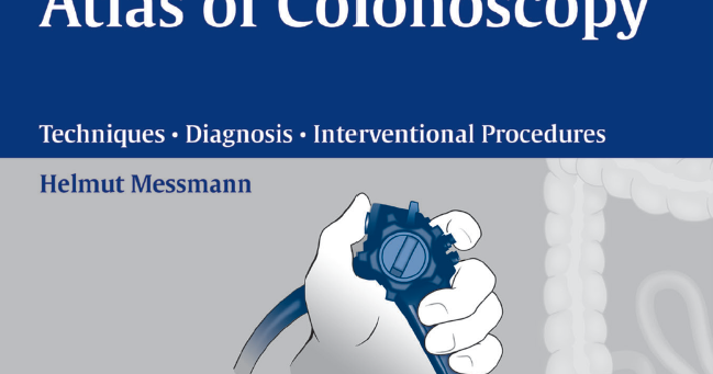 Atlas of Colonoscopy: Examination Techniques and Diagnosis 1st Edition ...