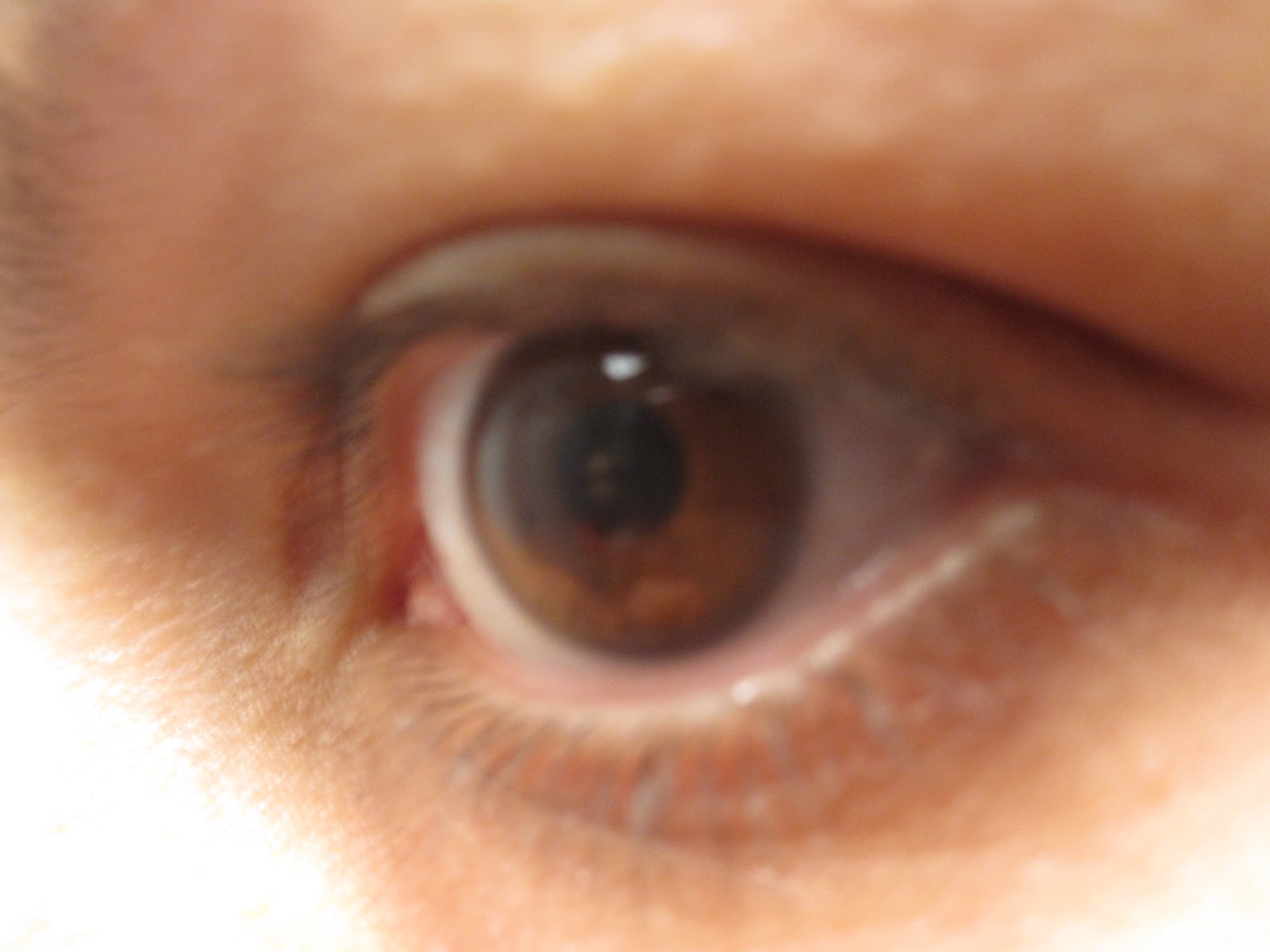 disconnected thoughts: Slavic "eye pockets"?