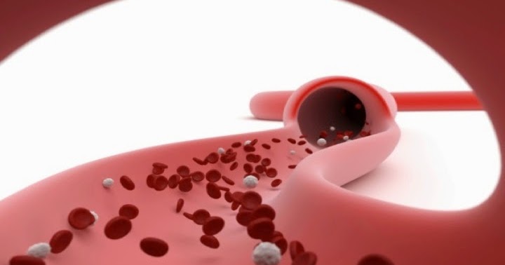 EmergenMed Health Blog: Anemia microcítica; Diagnóstico y tratamiento