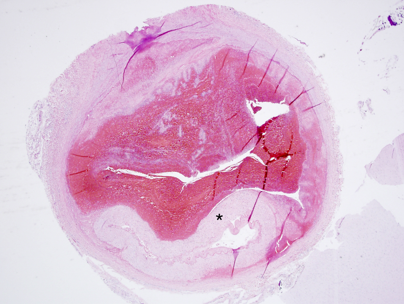 Nail Pathology Images