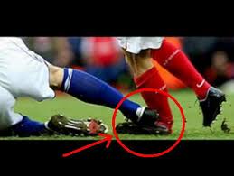 You Would Have to Be Crazy: Injuries in soccer games