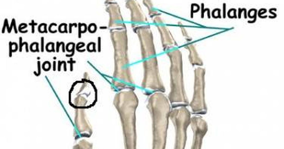 Carpometacarpal joint - Medically