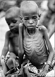 Desnutricion en Africa: Niños desnutridos!!!