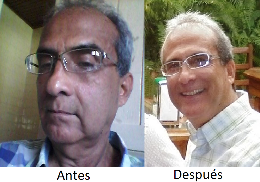 Doctor Marlon Paguaga Rodríguez ǀ Especialista en Terapia Neural ...