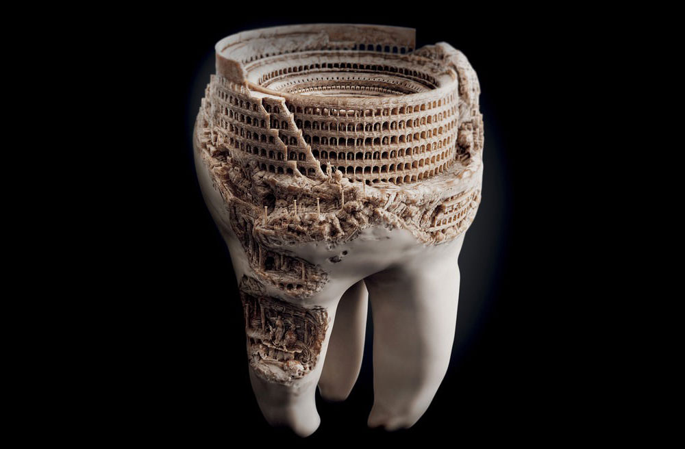 Tooth Cavity Art | Confidence
