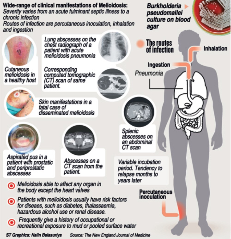 BERSAMA KITA KONGSIKAN KEBAIKAN SHAKLEE: KENALI PENYAKIT MELIOIDOSIS ...