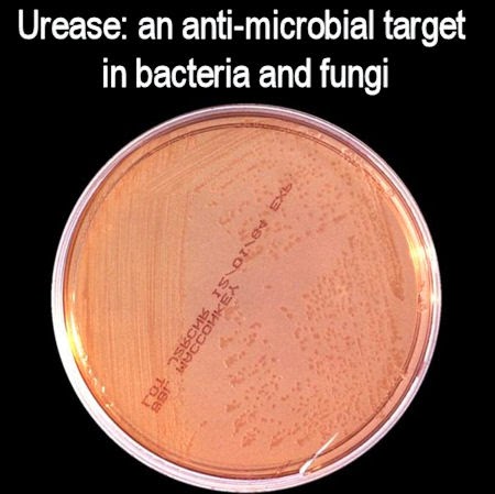Medical Laboratory and Biomedical Science: Urease: an anti-microbial ...
