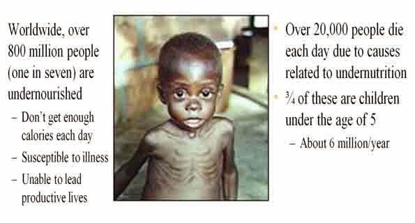 Protein Energy Malnutrition PEM Healthy Subjects protein-energy-malnutrition-pem-healthy-subjects