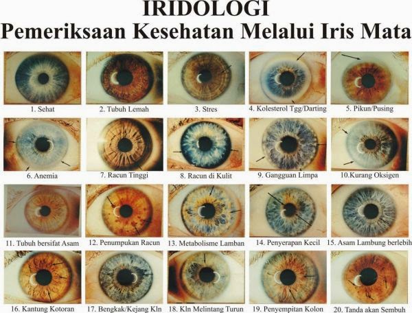 Rumah Sehat Al Syifa: Iridiologi (Diagnosa Iris Mata)