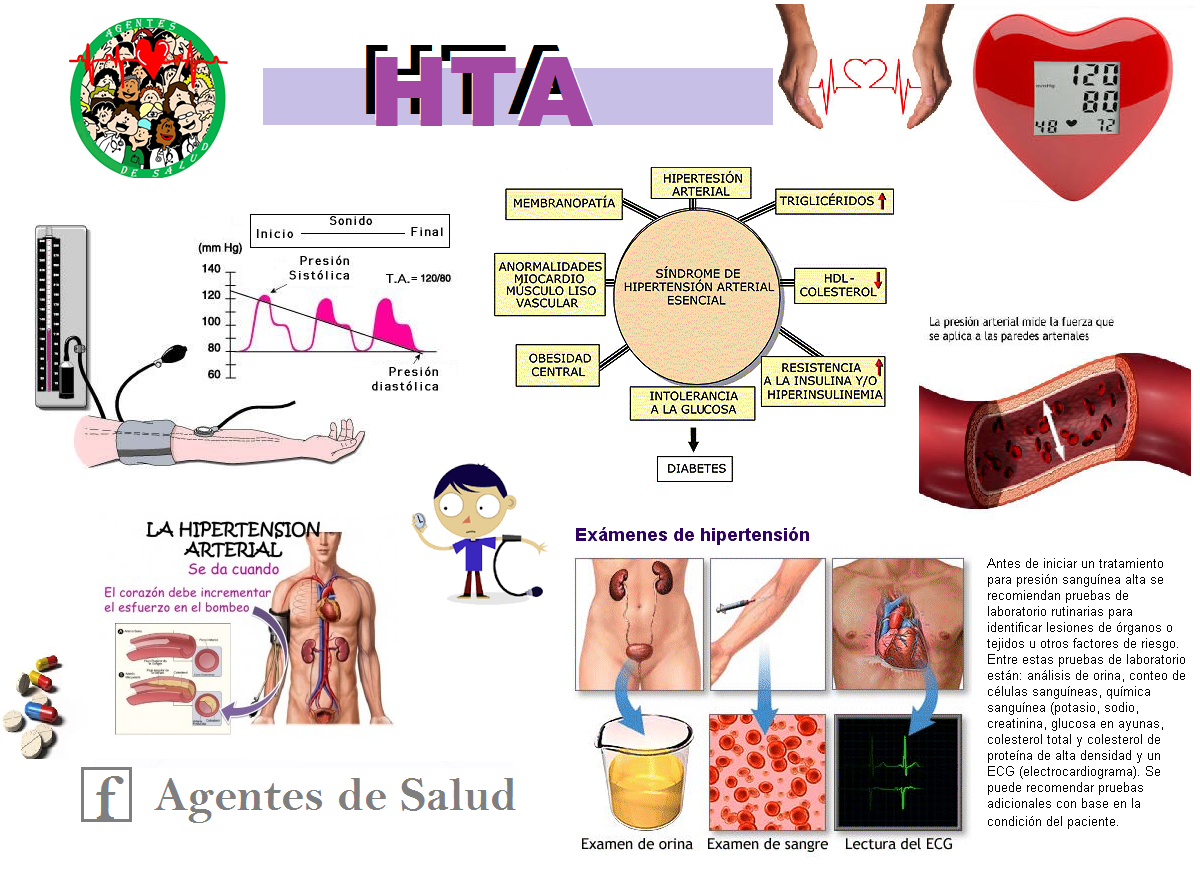 Agentes de Salud: Hipertensión arterial - HTA