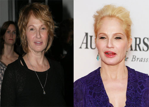 Ellen Barkin Plastic Surgery Before and After Botox Injections and Nose ...
