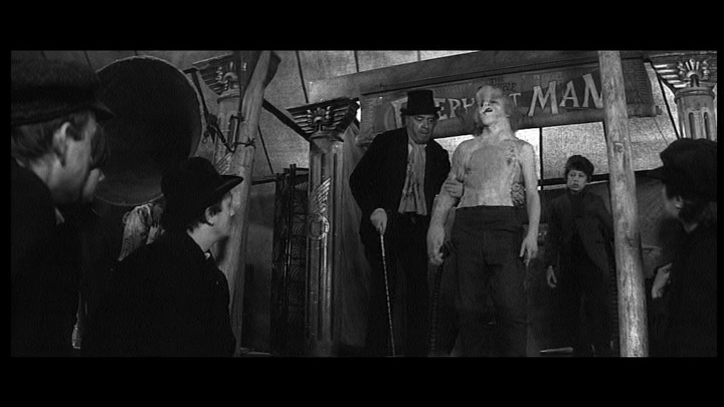 The Elephant Man 1980