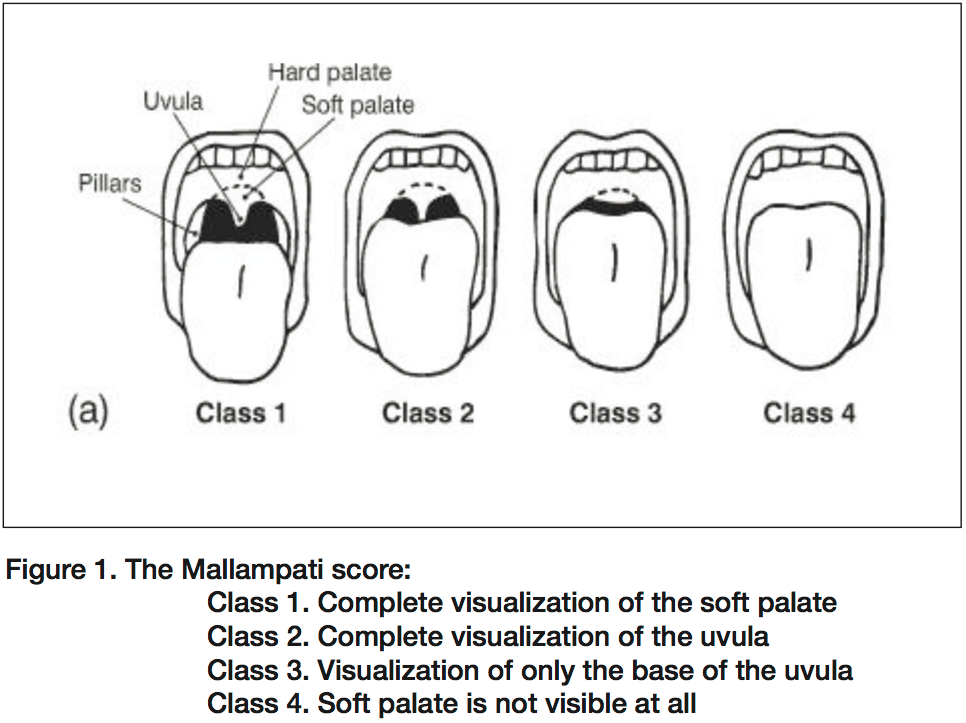 Enfermer@ en Urgencias y UCI : Intubación Difícil.