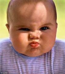 Causes for tall stature and obesity