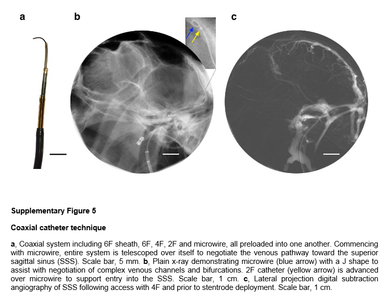 DARPA converts Stent into strentrode for recording neural activity ...