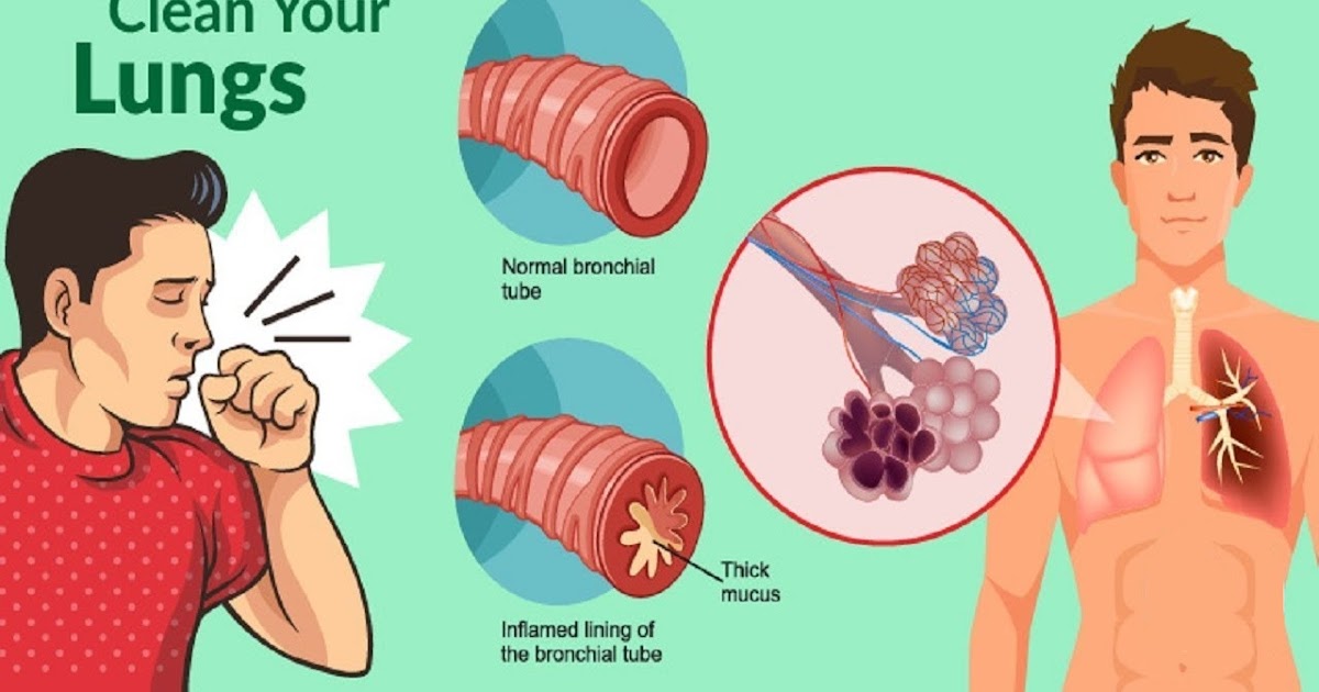 How to Get Rid of Phlegm and Mucus in Chest and Throat