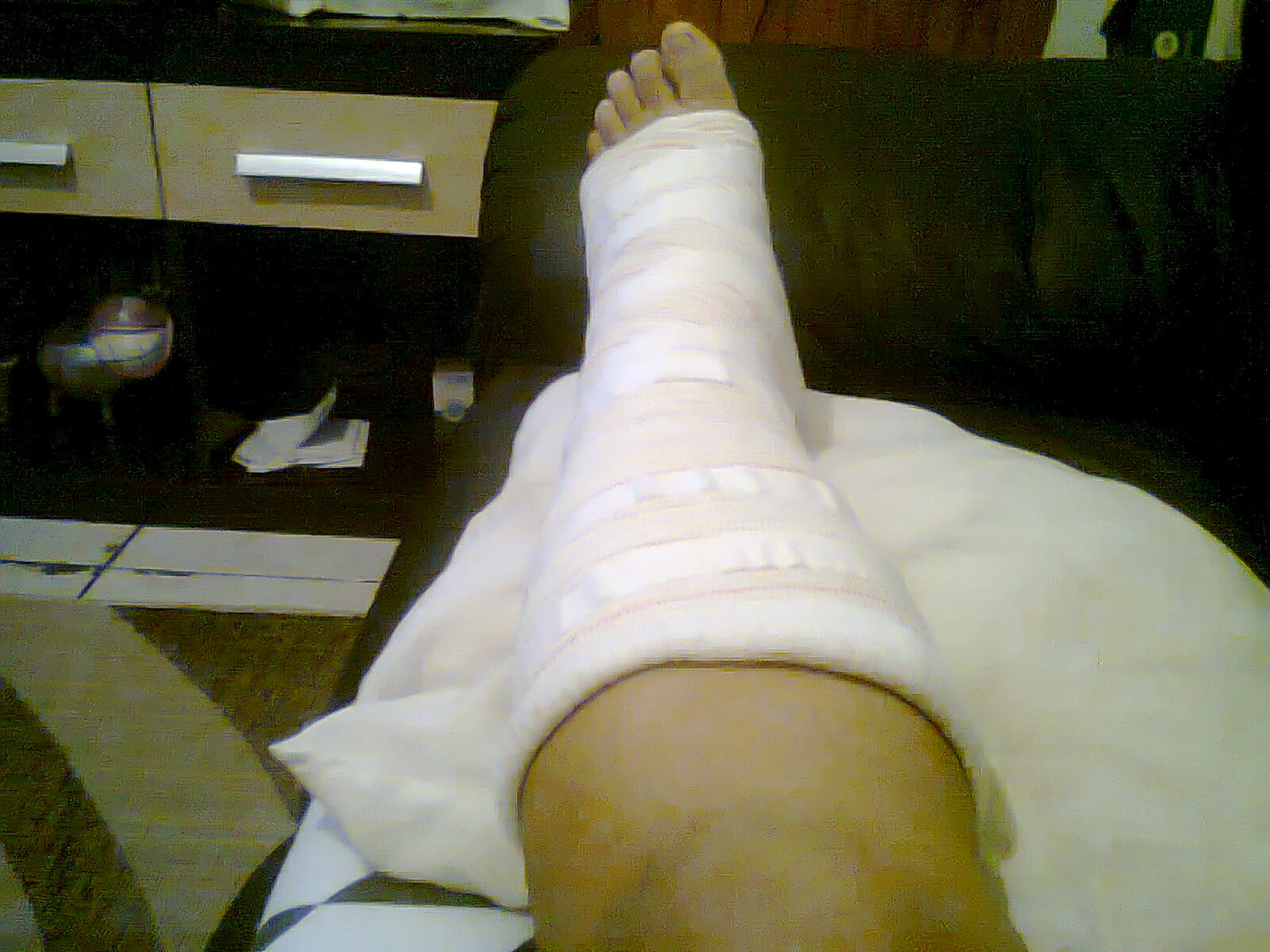 PALAVRAS DA ALMA: TALA GESSADA OU BOTA IMOBILIZADORA