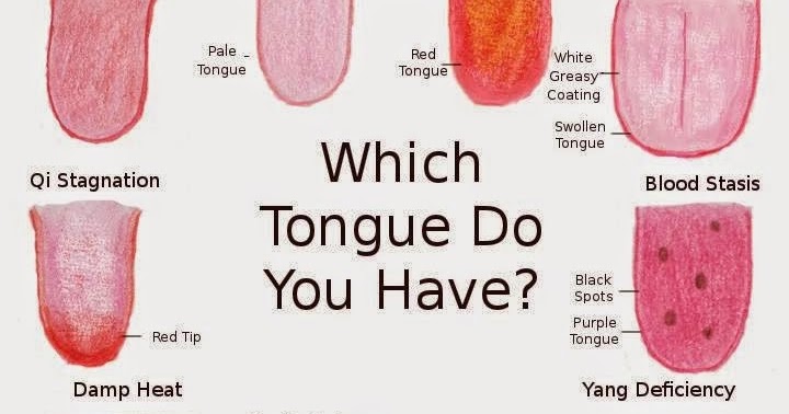 Nature Care: Yes! Your Tongue Color Can Reveal Health Problems – 7 ...