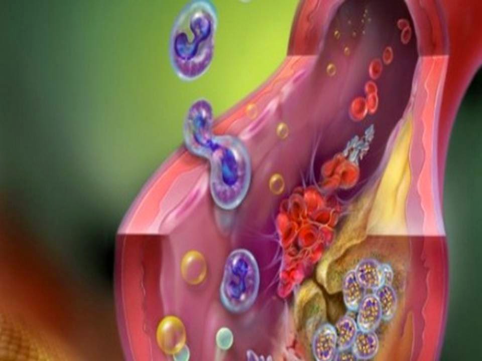 my beer store: Apa itu Trigliserida Tinggi dan Cara Menurunkannya