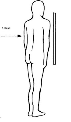 MedicoNotebook: CXR position