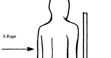 MedicoNotebook: CXR position