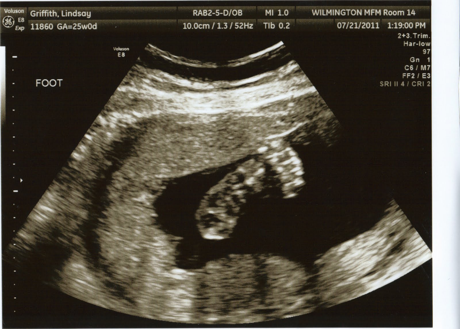 Growing Baby G!: 3D ULTRASOUND!!! Baby G at 25 weeks!