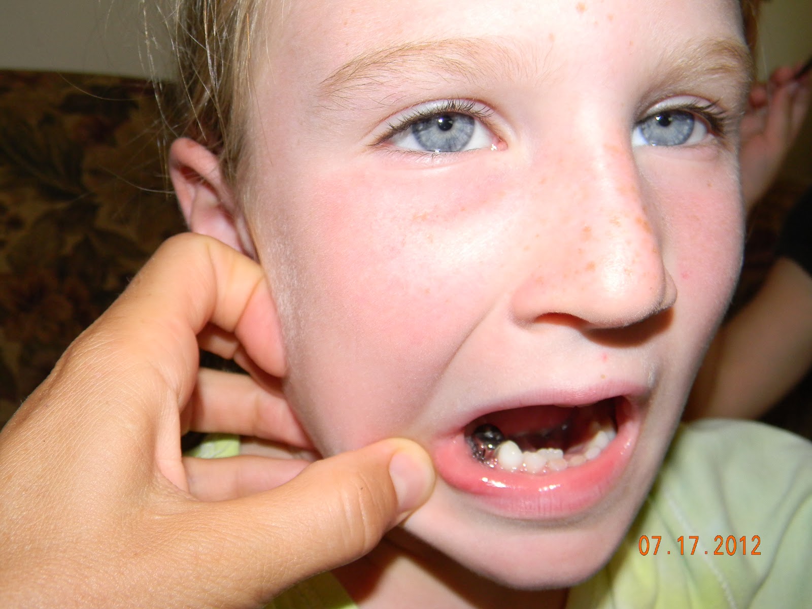 The Hill Family Journey: Enjoying the Moment!: Silver tooth!