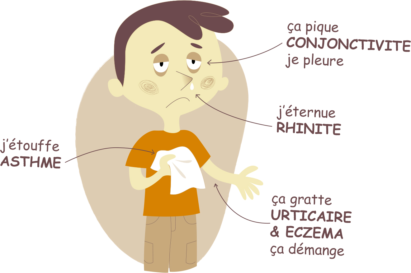 Allergie Tunisie: Comment confirmer le diagnostic d'une allergie?