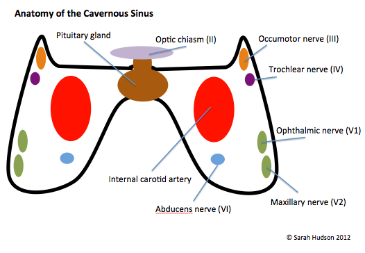 Cavernous Sinus Syndrome - MRCP Revision Notes