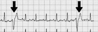 Dr David Grimes: A simple view of the ECG