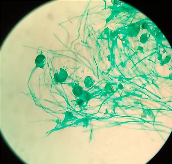 Bióloga Elena: Tipos de hongos