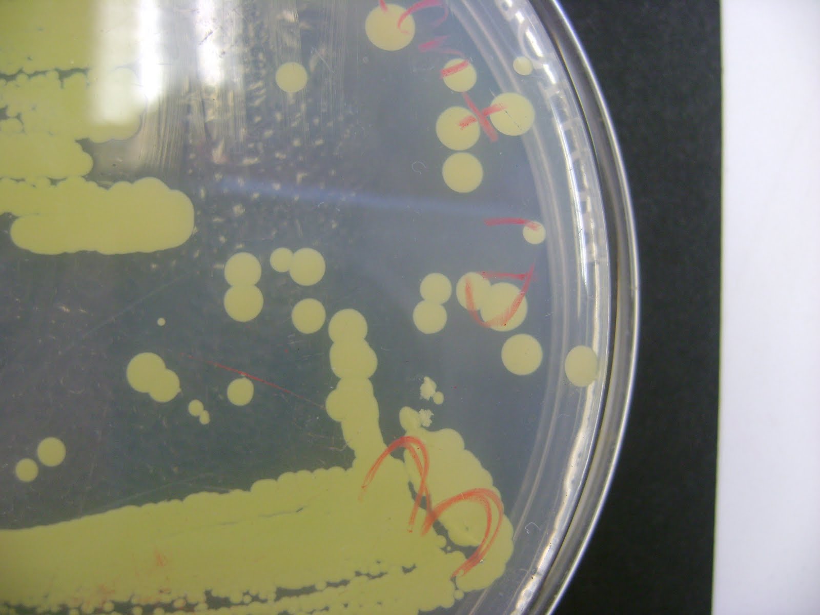MedicALI Microbiology: Preparing and Staining a Bacterial Smear