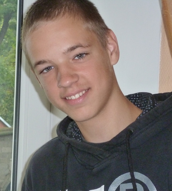 Fetal Alcohol Syndrome Teenager